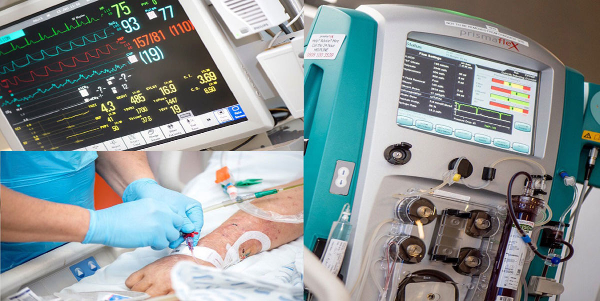 Critical Care – East Sussex Healthcare NHS Trust